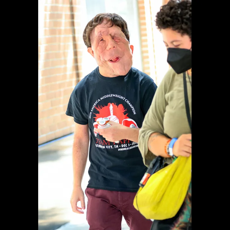 Adam Pearson Net Worth 2024: What Is The Actor Worth?