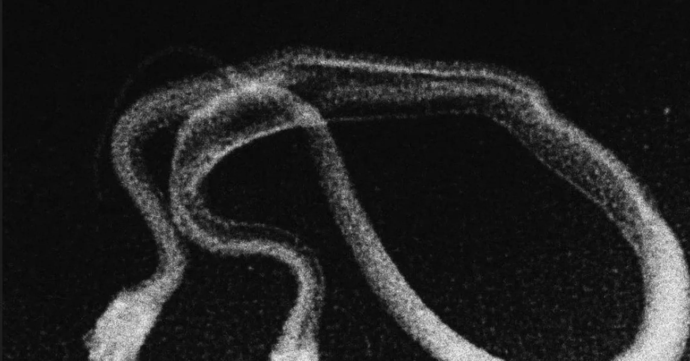 LUCKI Drops Off Two Singles On New EP "2 Faced"