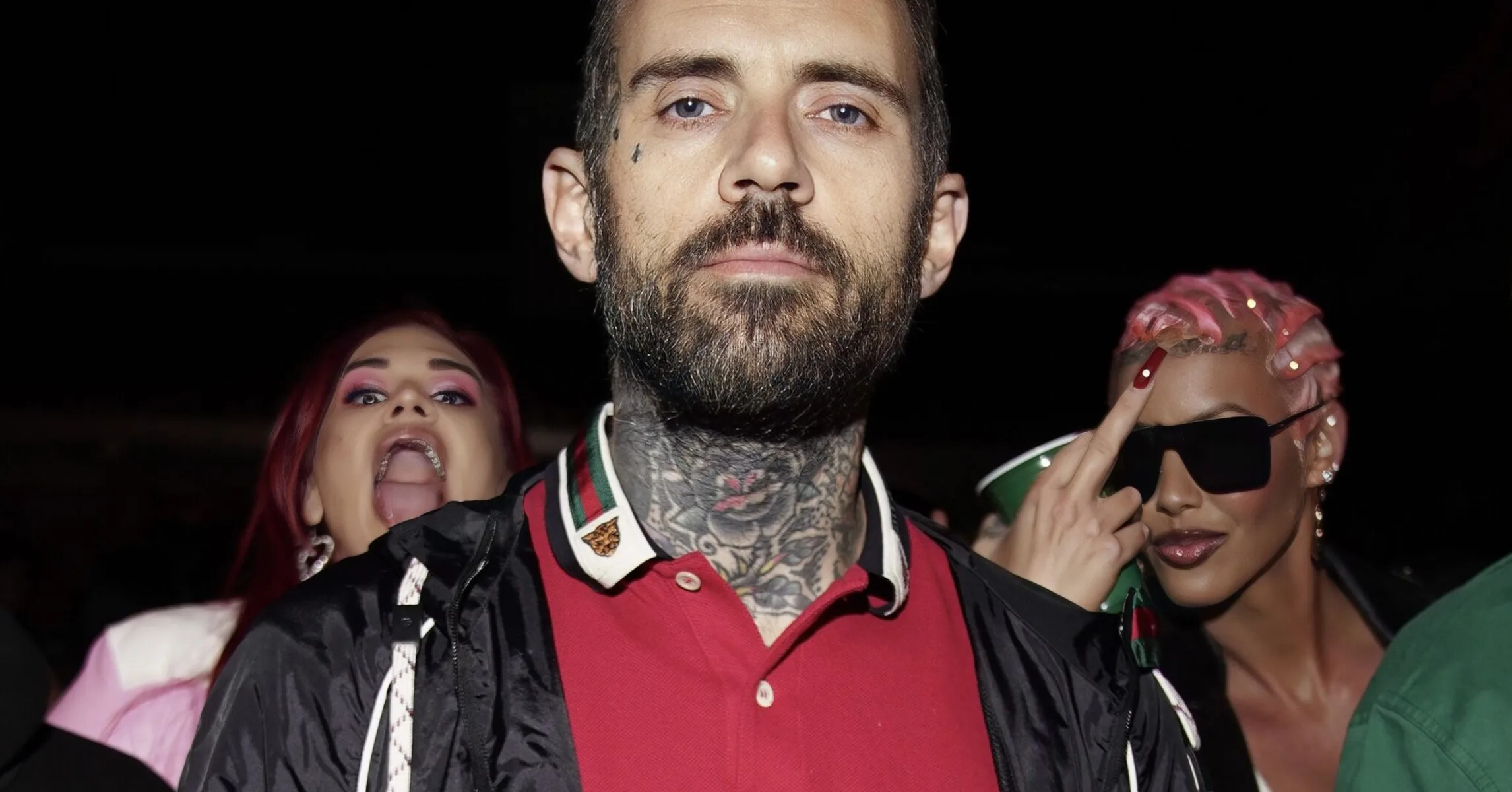 Adam22 Shows Off Hair Transplant Results