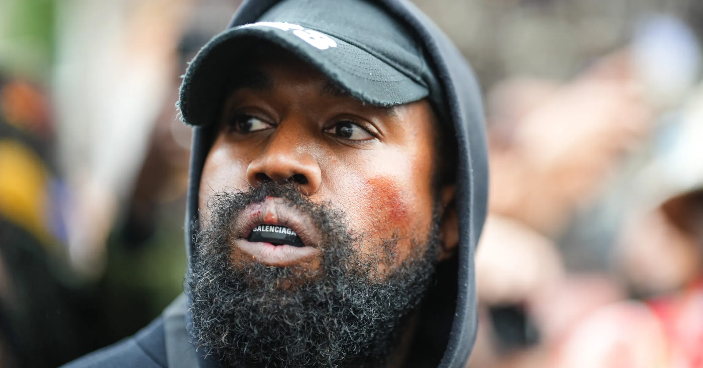 Kanye West Is Allegedly Addicted To Nitrous Gas