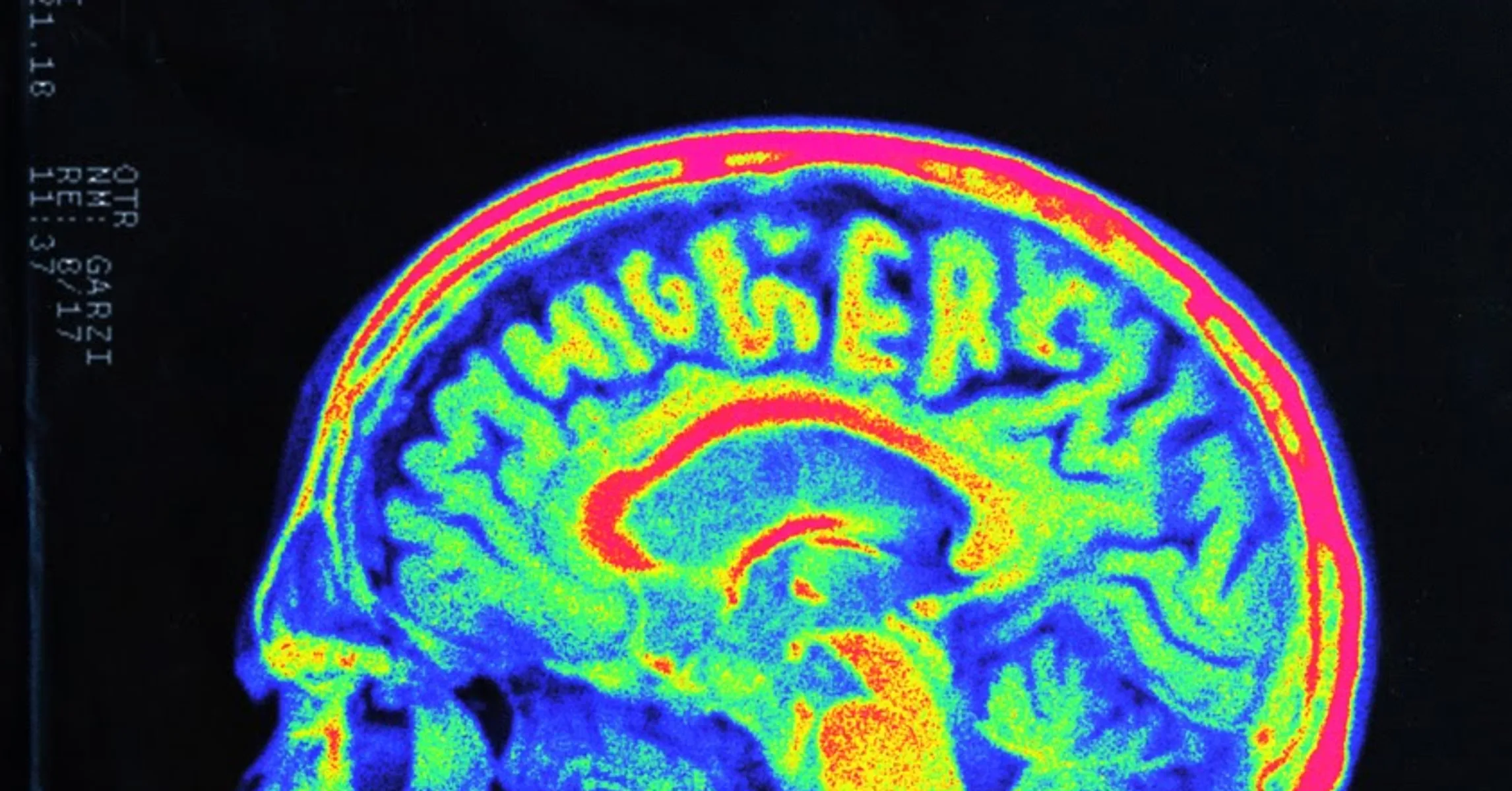 GARZI Continues To Expand His Catalog With Explosive Single "Higher"