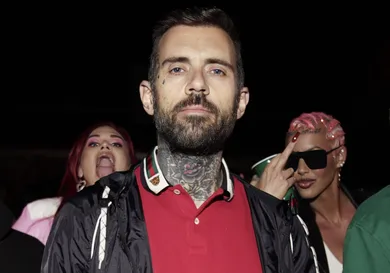 Adam22 Shows Off Hair Transplant Results