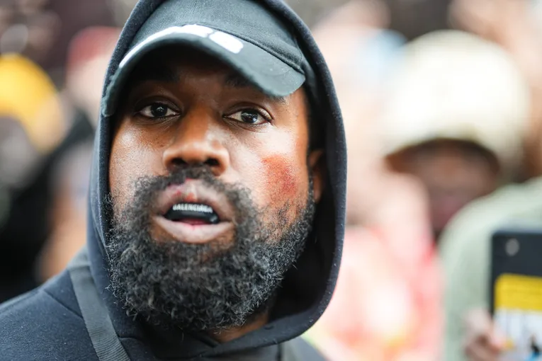 Kanye Nitrous Addiction: A Breakdown Of The Allegations